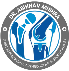 Patella Baja – Dr Abhinav Mishra
