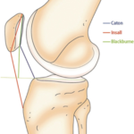 Patella Baja – Dr Abhinav Mishra